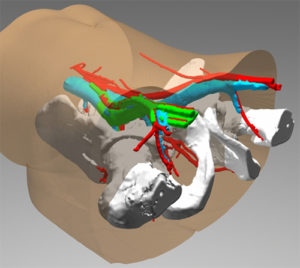 Less expensive and more realistic 3D models of blood vessels improve ...