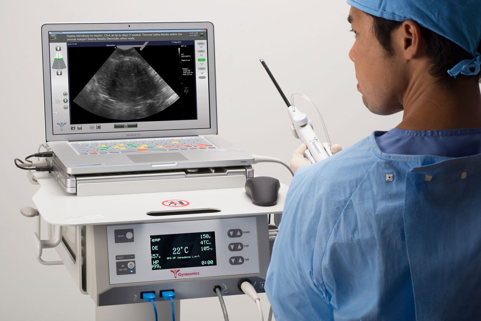 Gynesonics receives US FDA clearance to market Sonata system