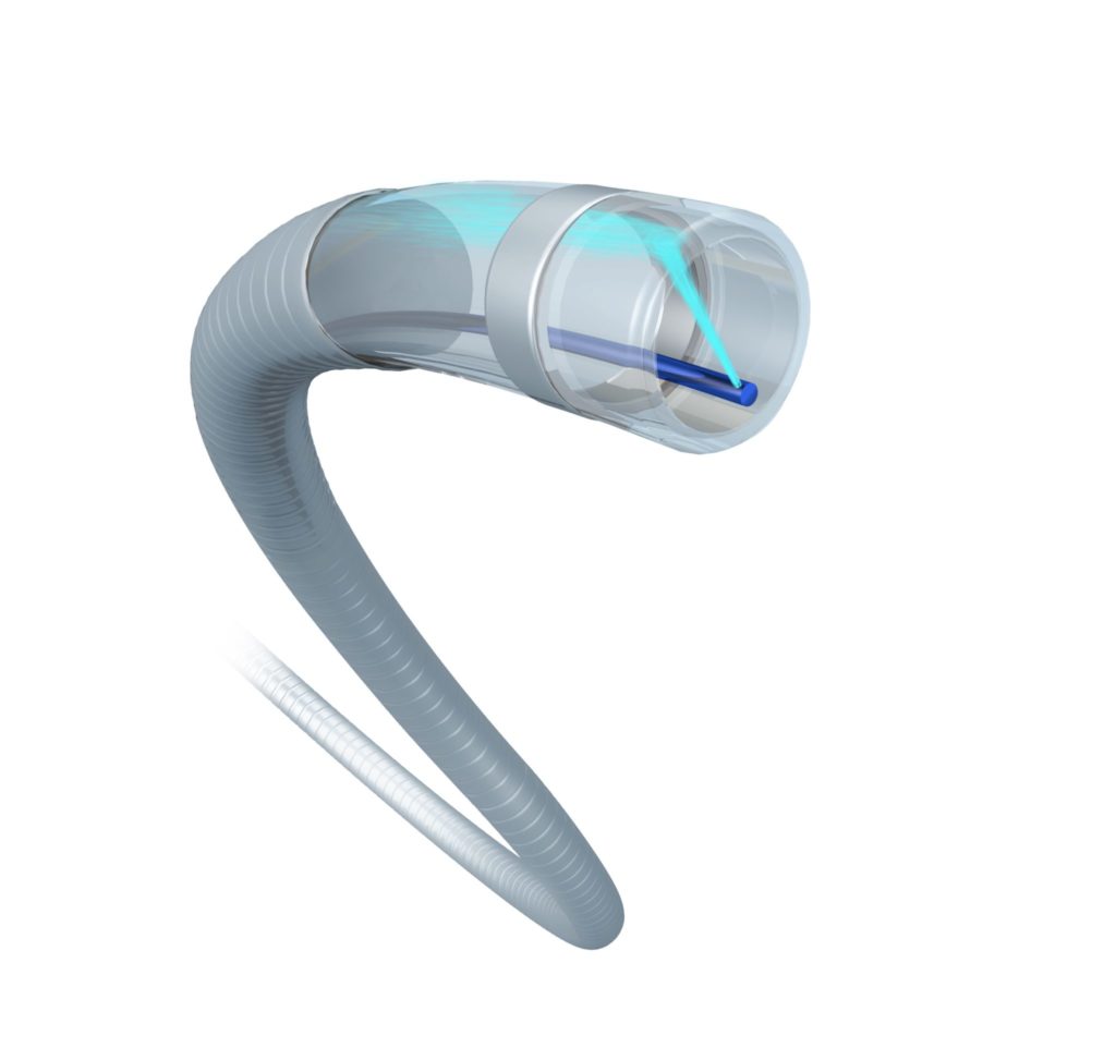 Veryan Medical to support commercialisation of Jeti thrombectomy system ...