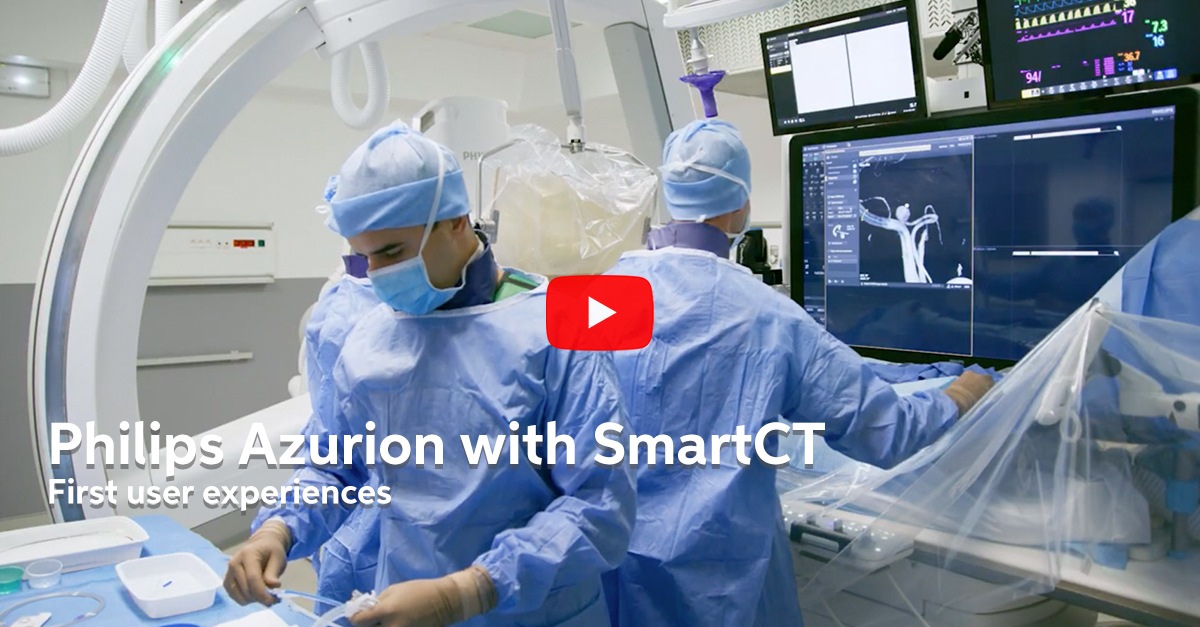Philips Azurion with SmartCT - first user experiences - Interventional News