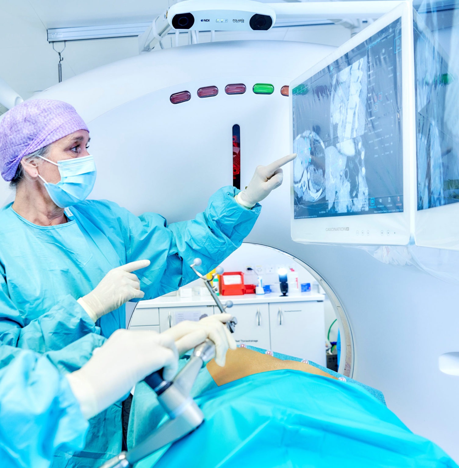 Quality Ablation: Treating challenging lesions with increased accuracy ...