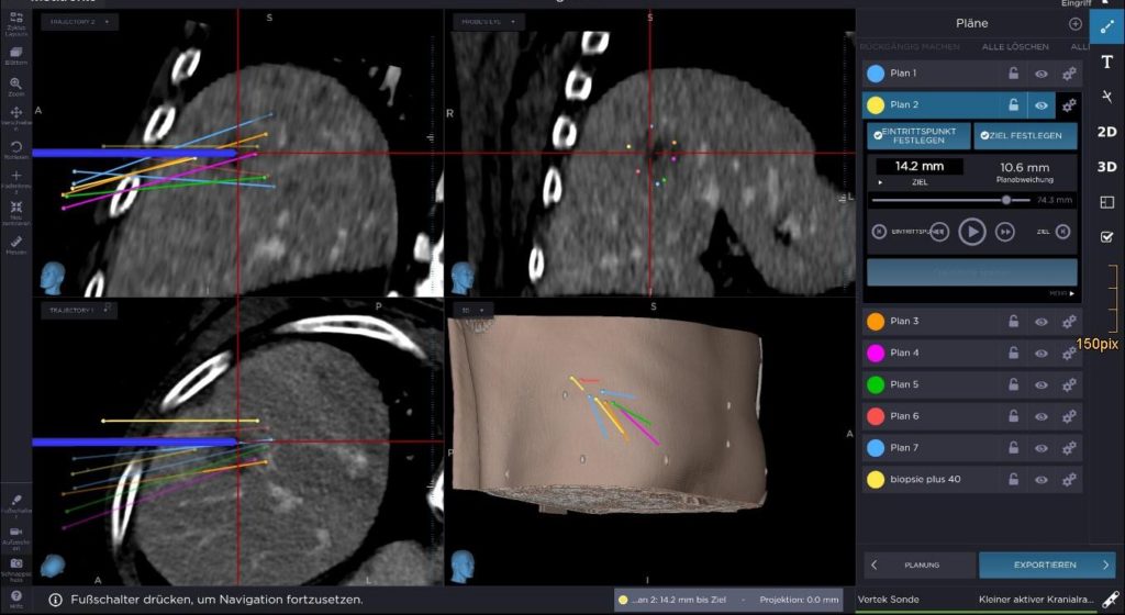 "Interventional oncology must become reliable and reproducible”