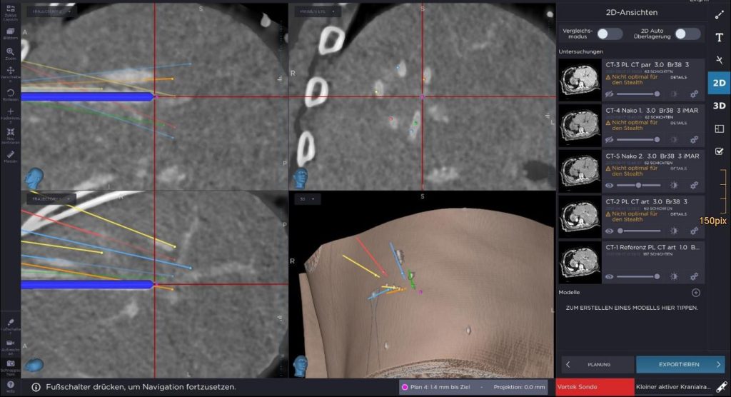 "Interventional oncology must become reliable and reproducible”