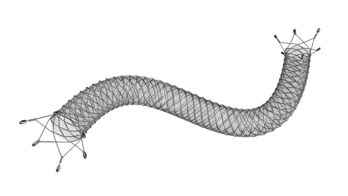 PRIZER study to put the spotlight back on bare metal stents ...
