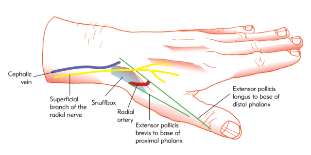 How to manage access via the distal radial route - Interventional News
