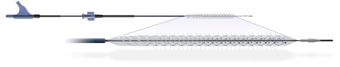 Reflow Medical receives CE mark for Bare Temporary Spur stent system ...