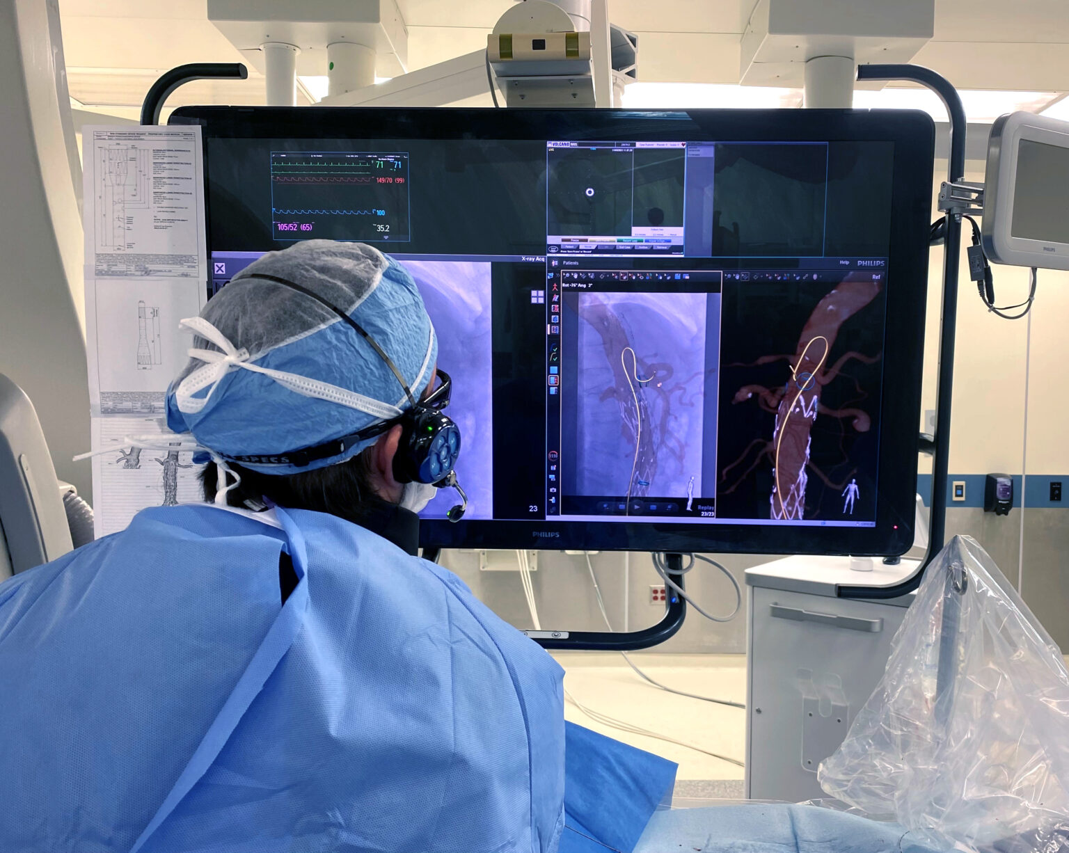 Philips announces LumiGuide 3D imaging technology availability in ...