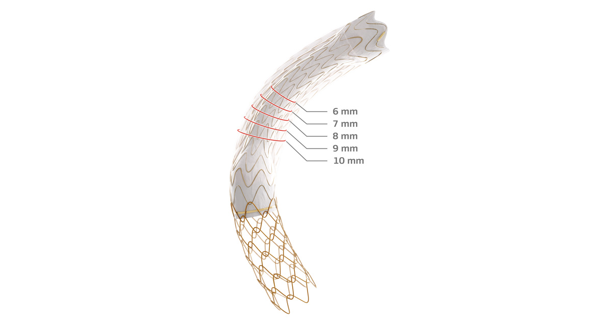 Gore announces US FDA approval of expanded Viatorr TIPS endoprosthesis ...